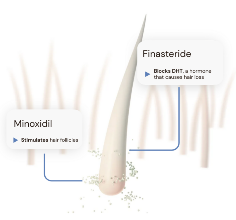 Finasteride 1mg (30 Tablets) – DIMA Health Technology Inc.